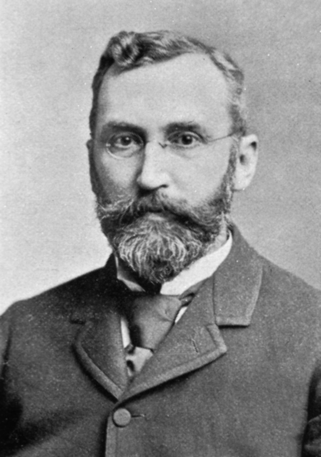 The Demon Face Of Edward Mordrake: It Could Whisper Horrific Things In ...
